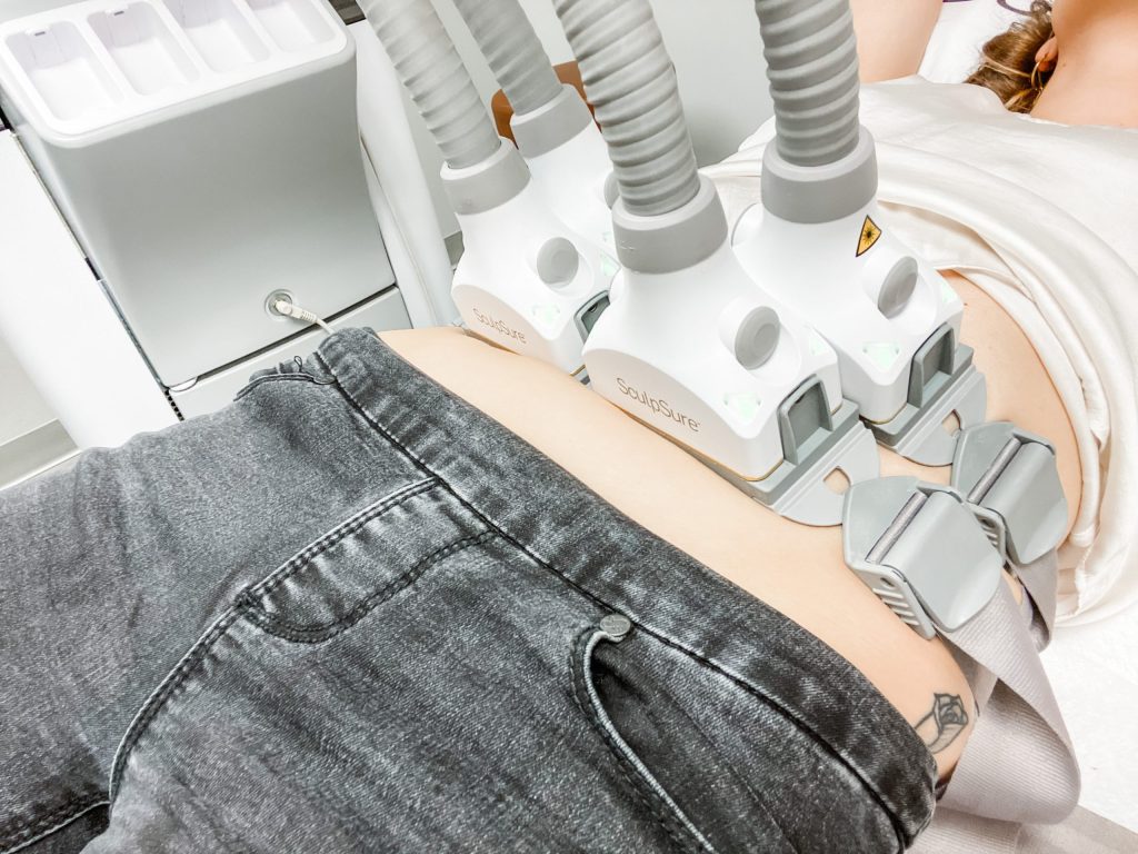 Is Sculpsure Better than CoolSculpting? - City Chic Living |Most ...