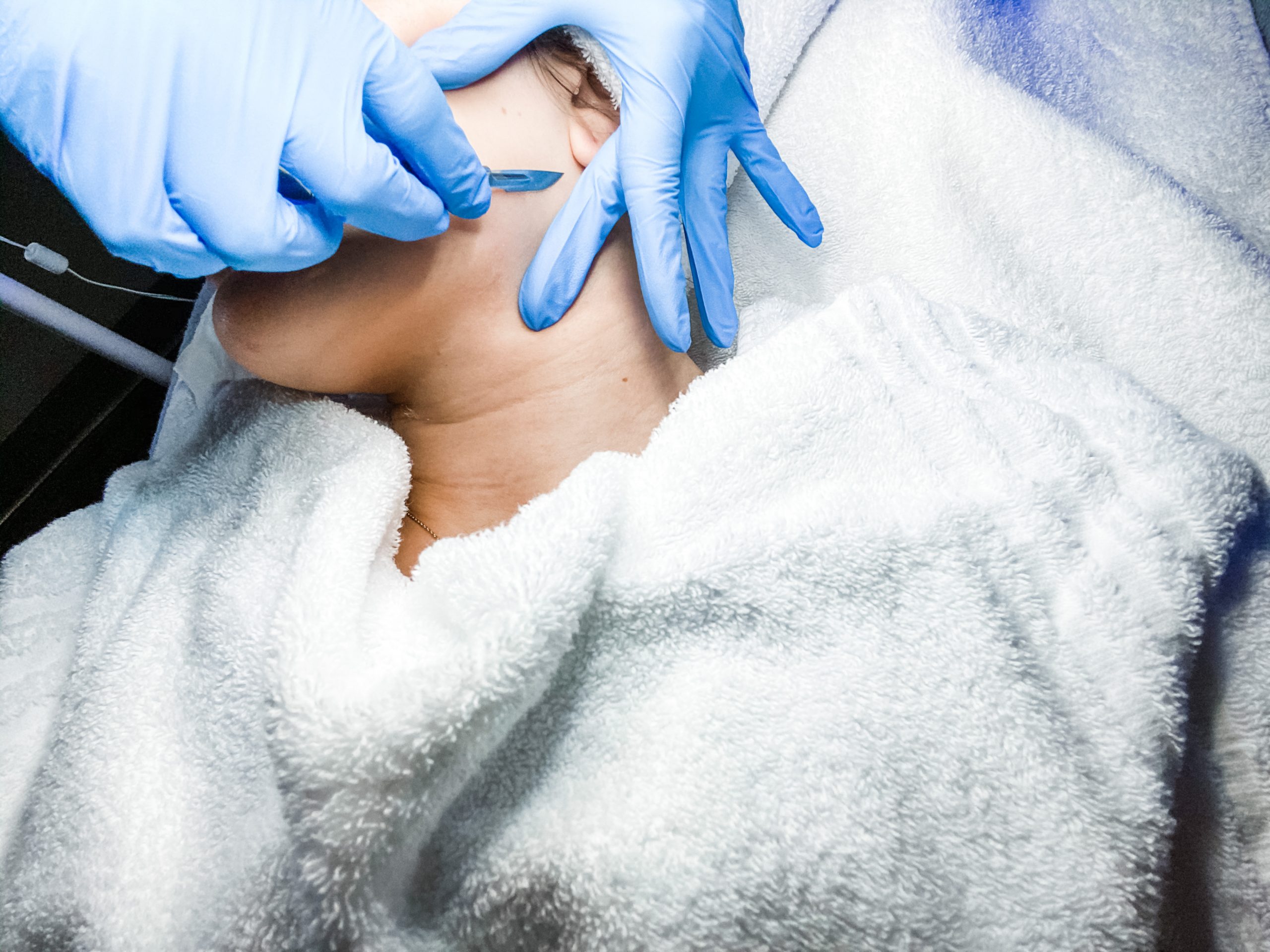 Why I Do a Monthly Dermablade - City Chic Living |Most Popular Mom Blog